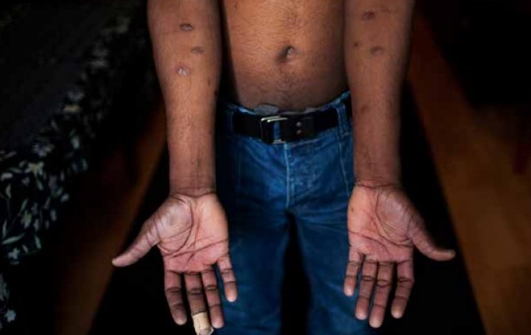 Sri Lanka Report To Un Committee Against Torture Is In A Denial Mode